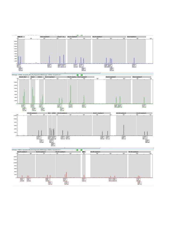 TritaFetusGene® Multiplex QF-PCR Diagnostic Kit - TritaGene
